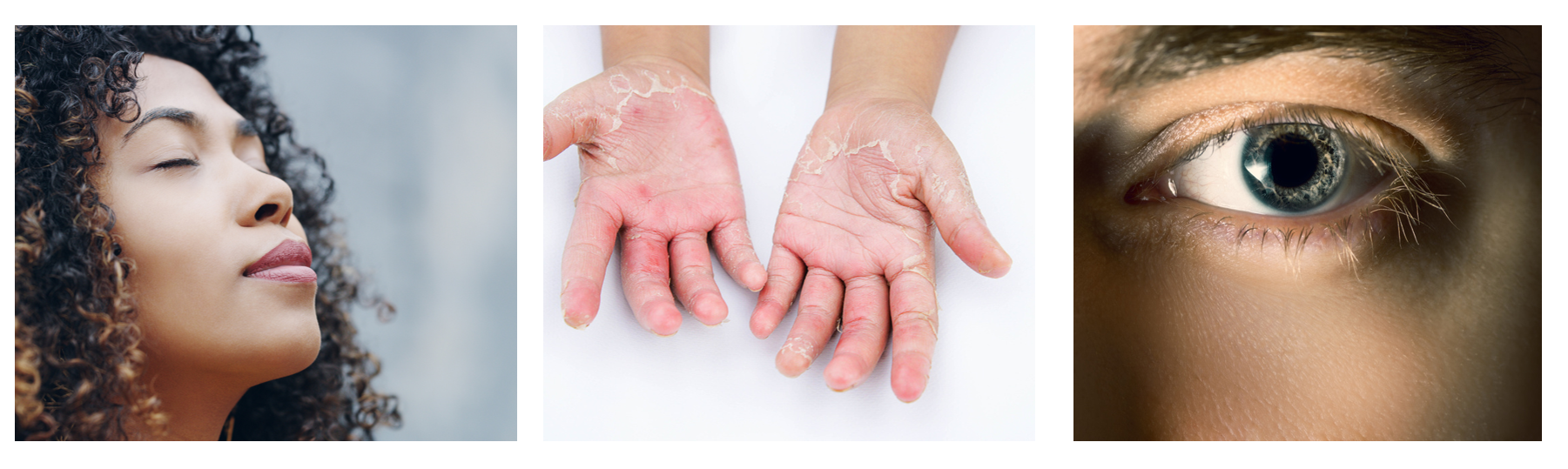 Bahaya Pajanan Benzena pada Kesehatan dan Penurunan TLV/TWA Benzena ...